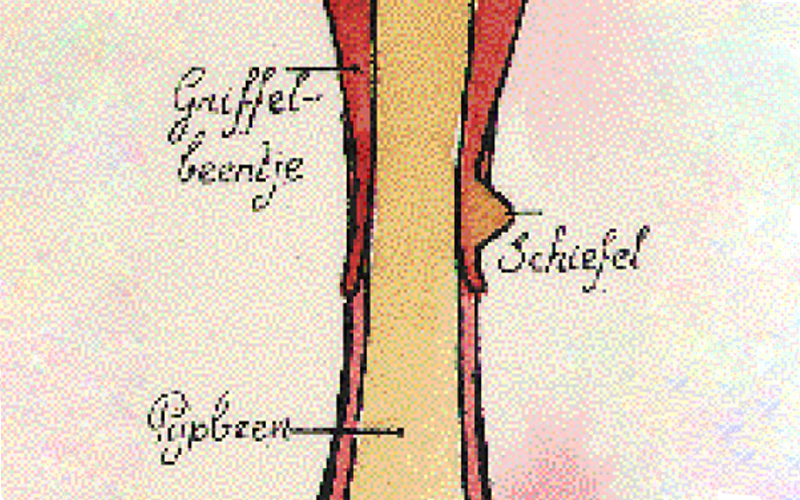 Schiefels - Penny - Lees hier alles over schiefels en wat je er tegen ...